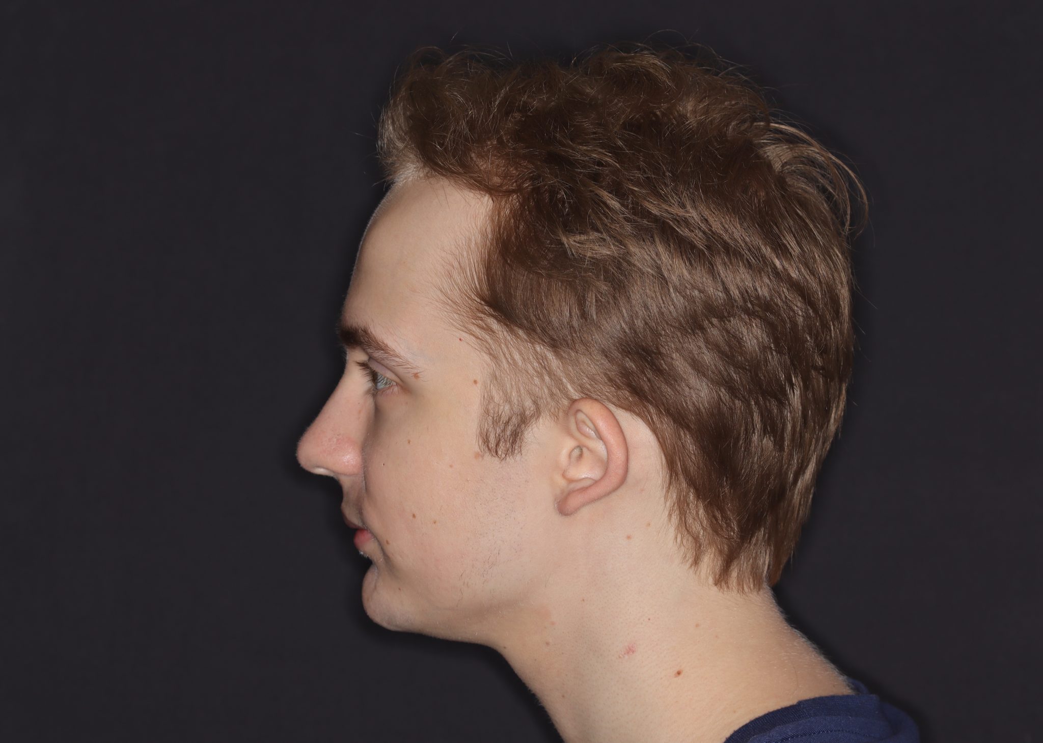 Mouth Breaking & TMJ | Contact Ronald W. Konig, DDS